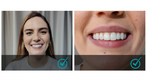 The Perfect Clinical Photography for Social Media – Enlighten Smiles Blog
