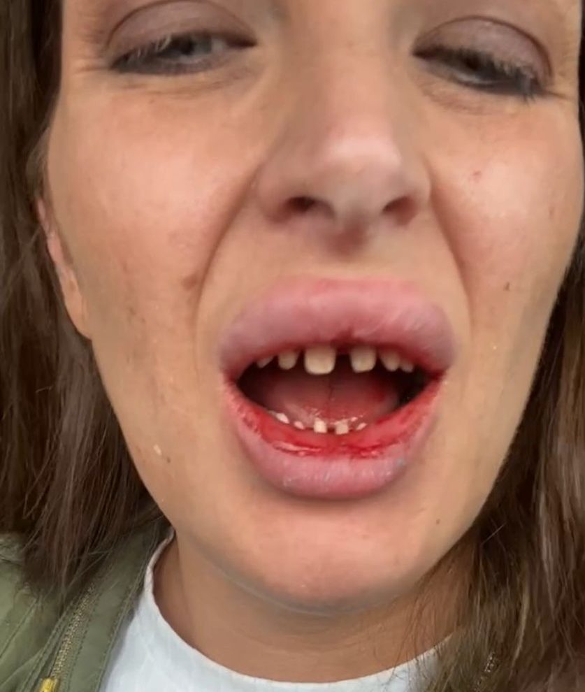 Turkey Teeth with Rhona Eskander – Enlighten Smiles Blog